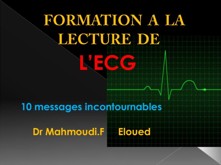 ECG LA LECTURE PRATIQUE POUR LES DEBUTANTS Archives - ETUDE-AZ