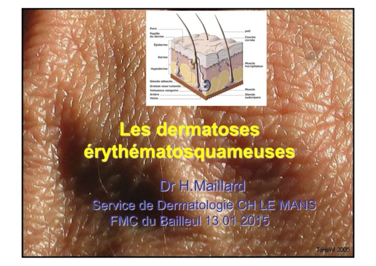 Cours de Dermatologie en pdf - ETUDE-AZ